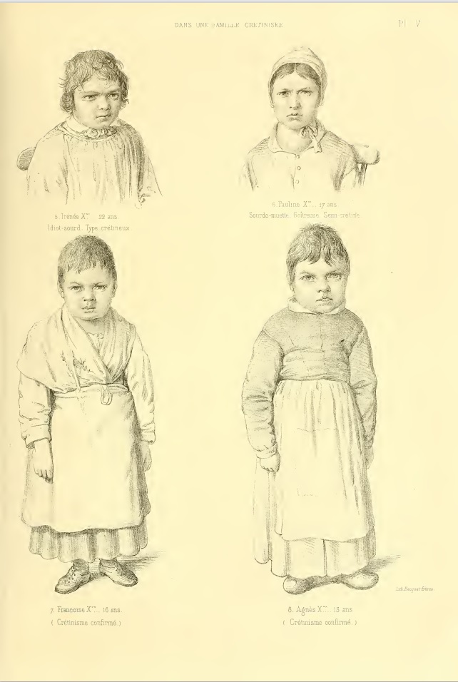 Identifier les causes du crétinisme : enquêtes et études étiologiques ...